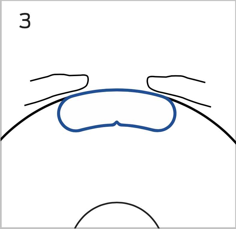 Method XL Spool Adapter