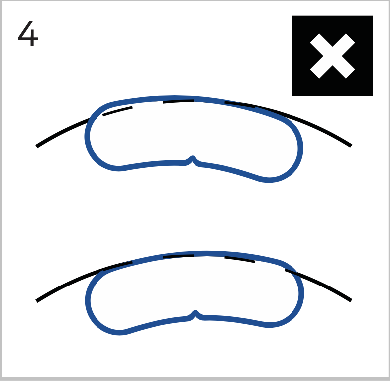Method XL Spool Adapter
